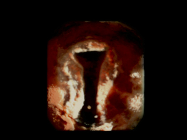 Advanced Ultrasound Diagnostic Unit - Mamata Fertility Hospital